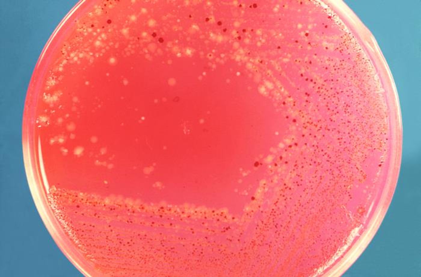 Bacterial Sex Allows Microbes To Share An Essential Vitamin Microbiology