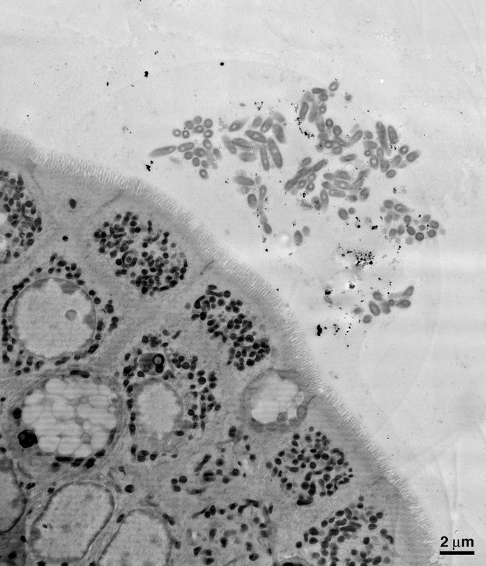 Understanding how the Microbiome is Built | Microbiology