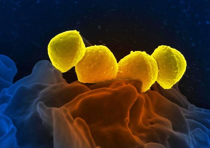 New Strain of Strep Linked to Rise in Infections | Microbiology