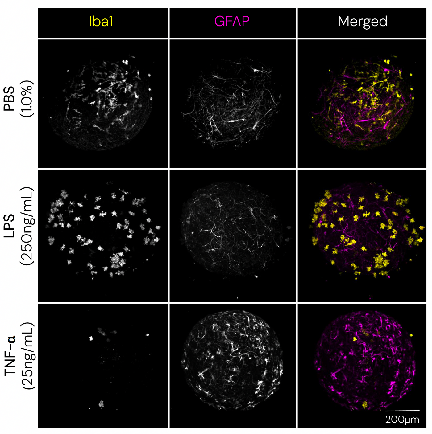 Evaluating CNS Anti-inflammatory Therapies with Human Brain Organoids ...