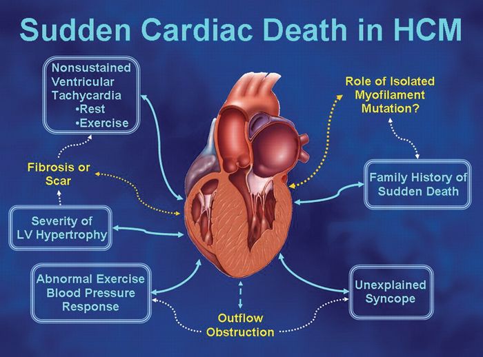 Which Of The Following Best Describes Hypertrophic Cardiomyopathy