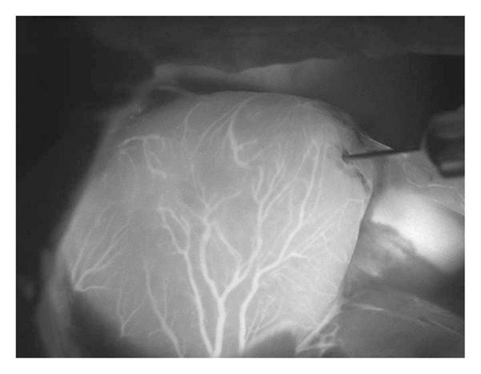 Optical Imaging in Tissue with Near-Infrared Dyes | Cell And Molecular ...