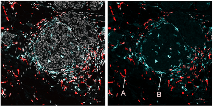 Pinpointing the Location of Gene Expression in Various Tissues ...