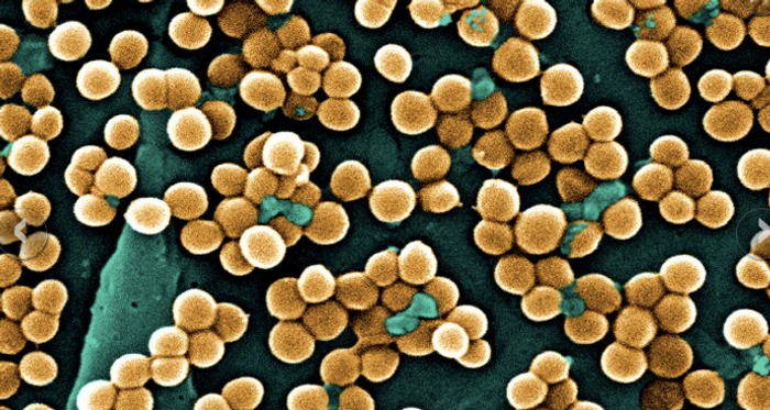Staph Bacteria can Sustain Infection by Eating Bone | Microbiology