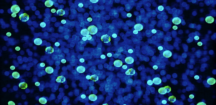 Exploring the Mystery of Archaea in the Vertebrate Gut | Microbiology