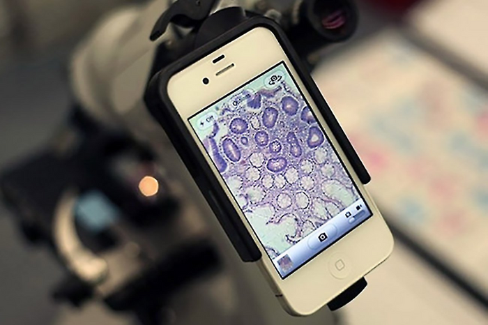Using a Smartphone to Diagnose Parasitic Diseases | Microbiology