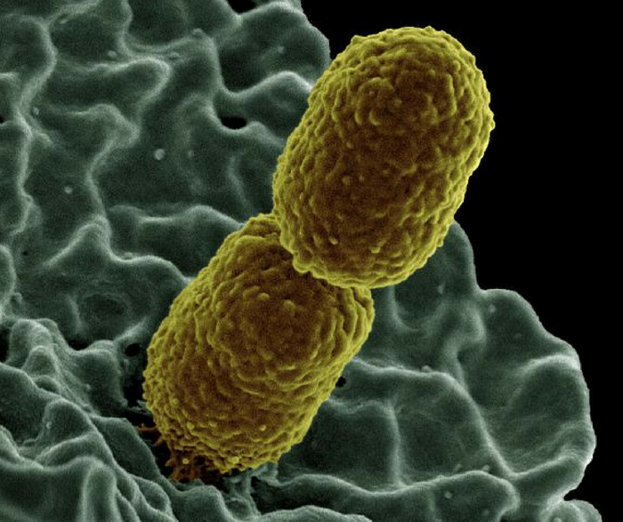 The Immune System's Antibodies Target Multiple Microbes | Immunology