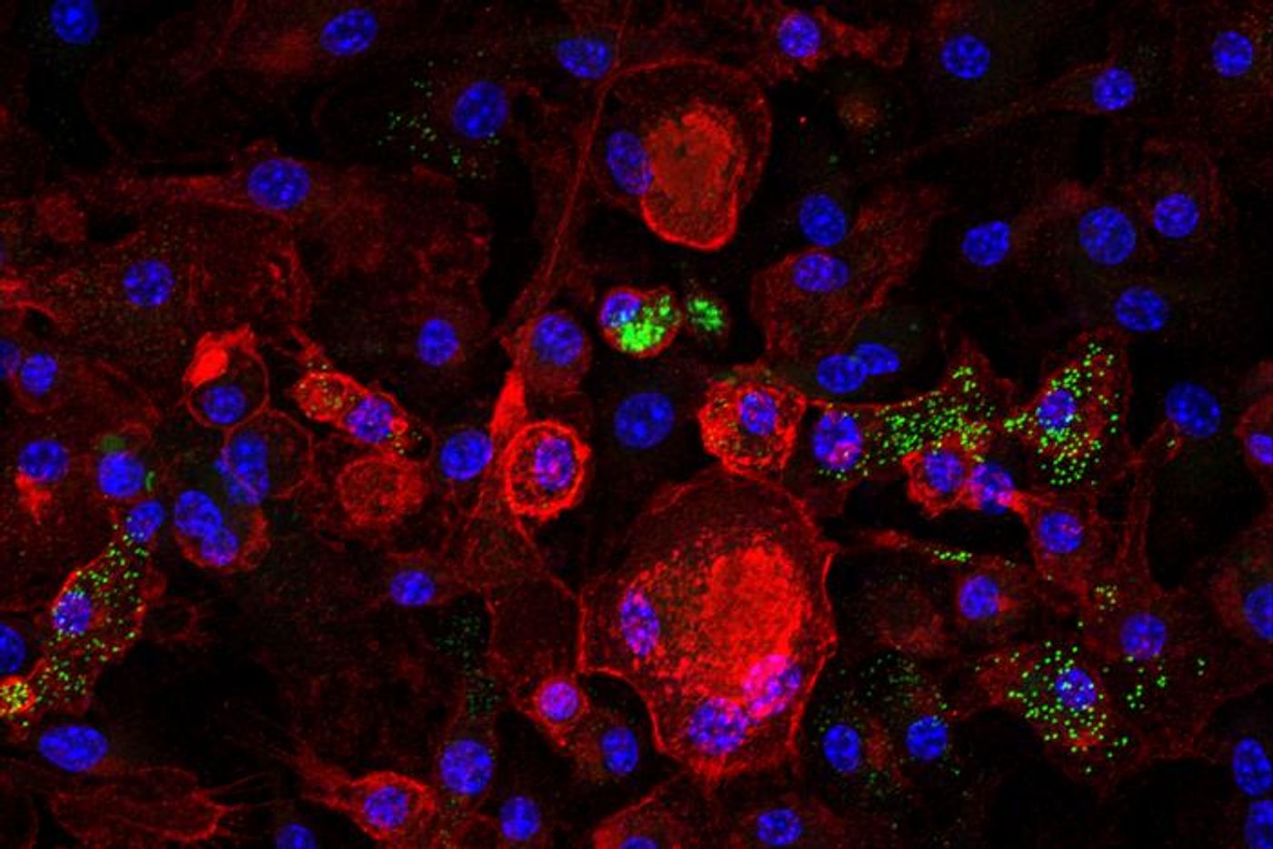 How Zombie Immune Cells Drive Fatty Liver Disease | Cell And Molecular ...