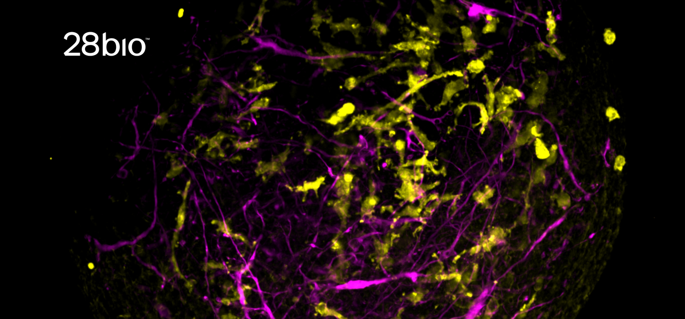 Evaluating CNS Anti-inflammatory Therapies with Human Brain Organoids ...