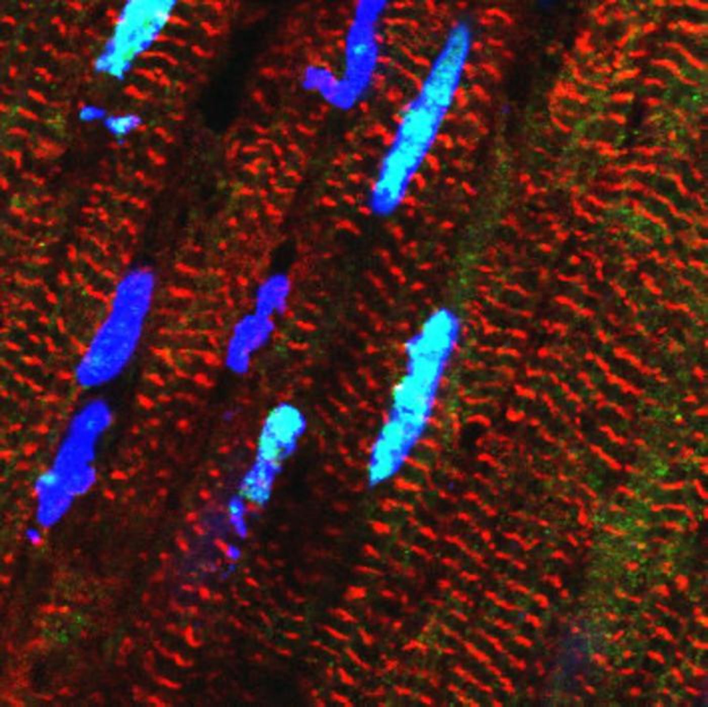 Scientists Reveal a Novel Layer of Gene Regulation in the Heart ...