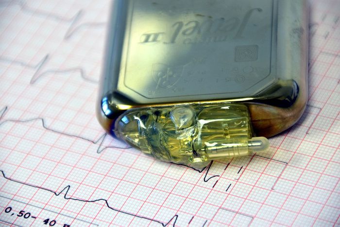Micropacemaker Provides New Cardiac Pacing Options | Cardiology
