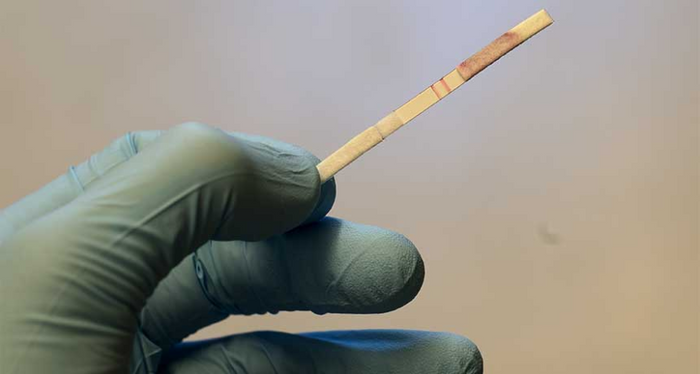 Scientists Develop Rapid Paper Strip Test for Detection of Resistant ...