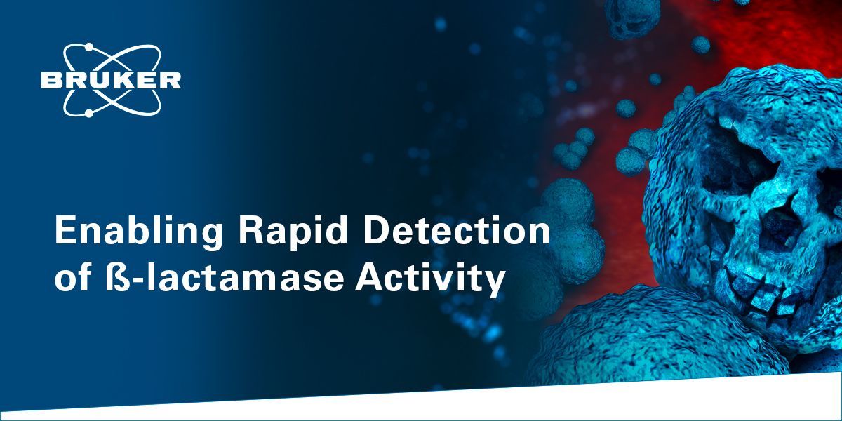 eyJidWNrZXQiOiJsYWJyb290cy1pbWFnZXMiLCJrZXkiOiJ3ZWJpbmFyX3Byb2ZpbGVfaW1 ...