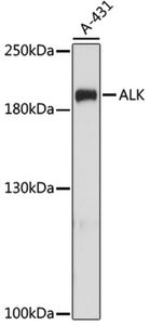 Anti-ALK antibody | Science Company | Labroots