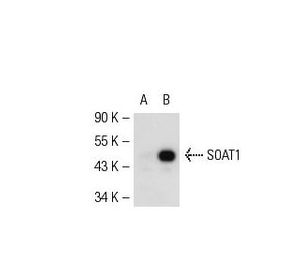 SOAT1 (A-11) | Science Company | Labroots