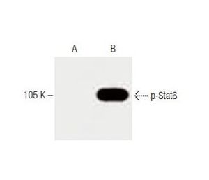 p-Stat6 (pY641.18) | Science Company | Labroots
