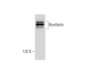 Rootletin (E-5) | Science Company | Labroots