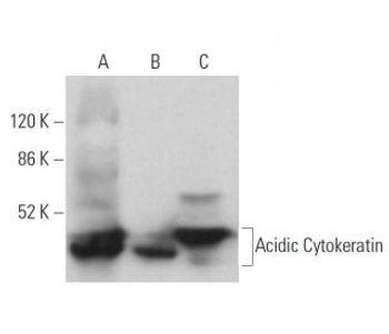 Acidic Cytokeratin (3G128) | Science Company | Labroots