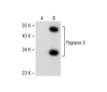 Pygopus 2 (B-4) | Science Company | Labroots