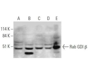 Rab GDI β (D-2) | Science Company | Labroots