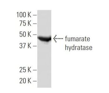 fumarate hydratase (J-13) | Science Company | Labroots