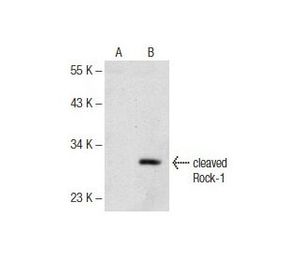 cleaved Rock-1 (154C1465) | Science Company | Labroots