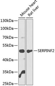 Anti-SERPINF2 antibody | Science Company | Labroots