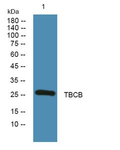 Anti-TBCB antibody | Science Company | Labroots