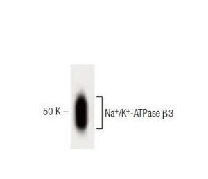 Na+/K+-ATPase β3 (46) | Science Company | Labroots