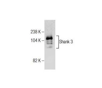 Shank 3 (C-4) | Science Company | Labroots