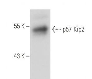 p57 Kip2 (SPM308) | Science Company | Labroots