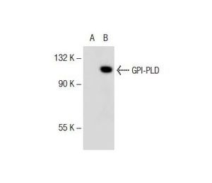 GPI-PLD (E-5) | Science Company | Labroots