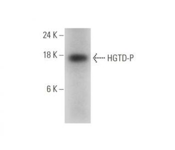 HGTD-P (E-8) | Science Company | Labroots