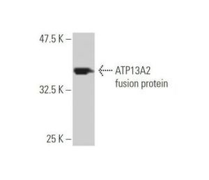 ATP13A2 (4B7) | Science Company | Labroots