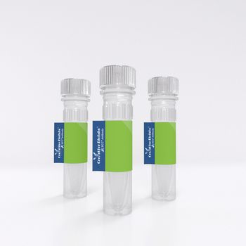 Anti-Human Complement component C3 (C3c) Monoclonal Antibody (clone 4 ...