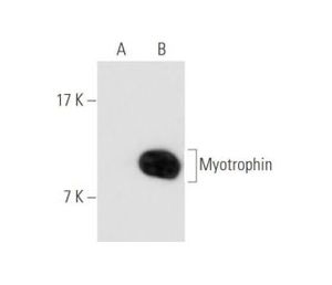 Myotrophin (D-3) | Science Company | Labroots
