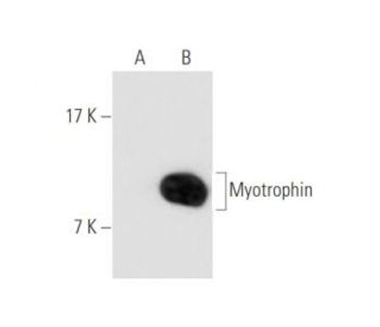 Myotrophin (D-3) | Science Company | Labroots