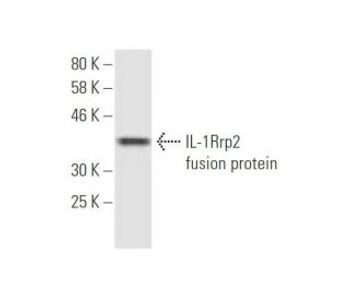 IL-1Rrp2 (5G5) | Science Company | Labroots