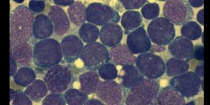 10 Most Common Genetic Diseases Infographic | Infographics