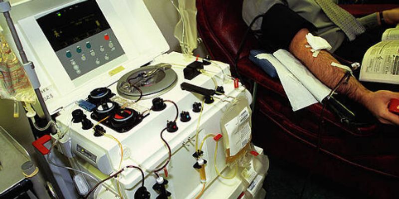 Apheresis | | Content Tag